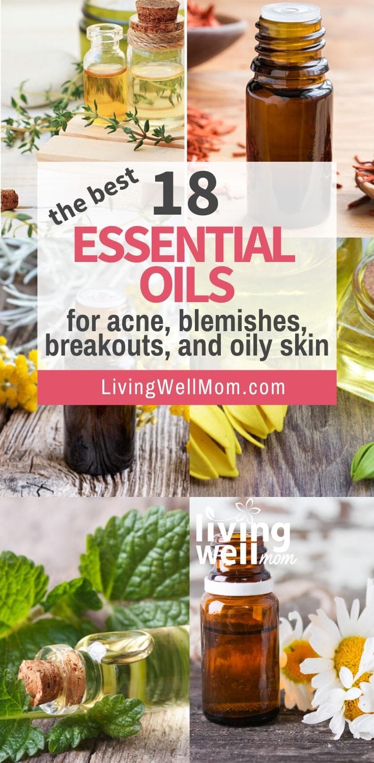 The 18 Best Essential Oils for Acne, Pimples, and Oily Skin + How to ...